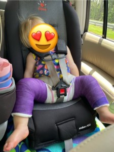 Life with a Spica Cast – Baby/Toddler – Tips, Resources, and Gear – Hip ...